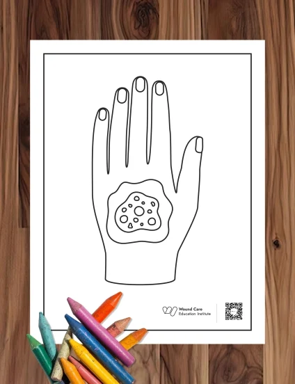 Wound Care Coloring Pages | WCEI